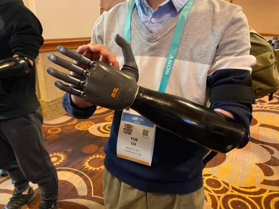 New AI Powered Prosthetic Hand can be moved with your Mind - Gizmochina