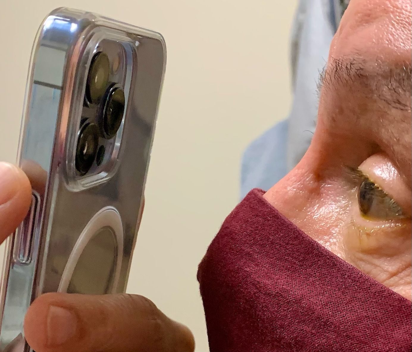 Doctor uses Apple iPhone 13 Pro Max Macro camera mode to check eyes ...