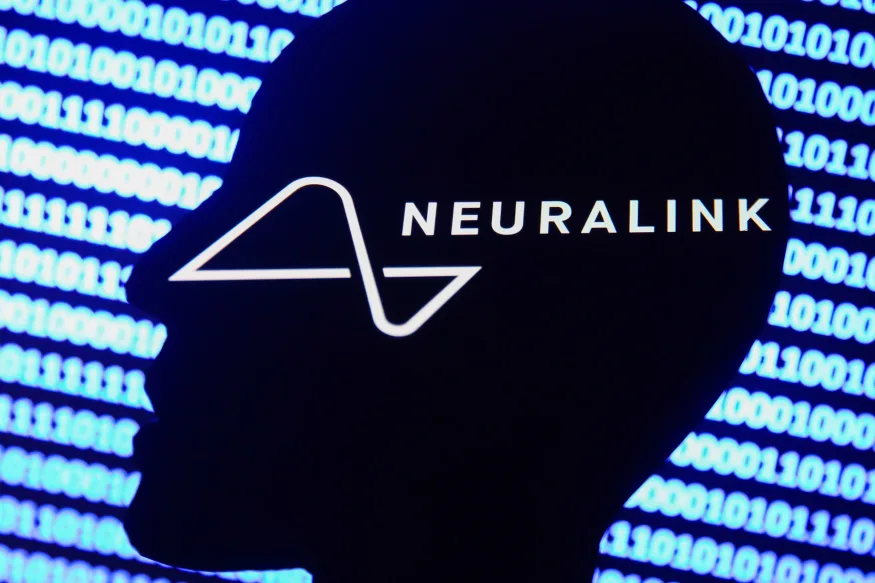 First Neuralink Successfully Implanted in a Human Patient - Gizmochina